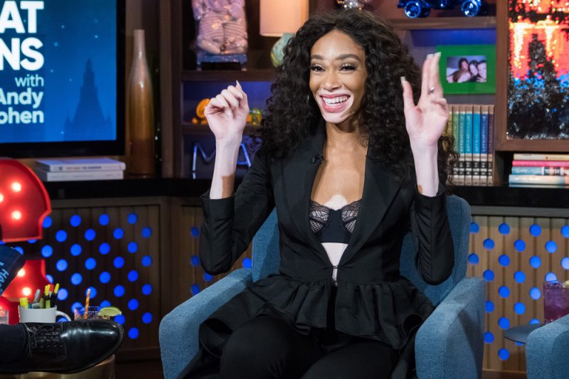 Winnie Harlow: 'America's Next Top Model' did nothing for my career ...